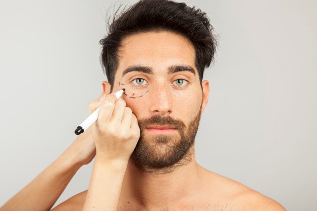 Se debarrasser des cernes avec les techniques esthetiques - CSHP Paris